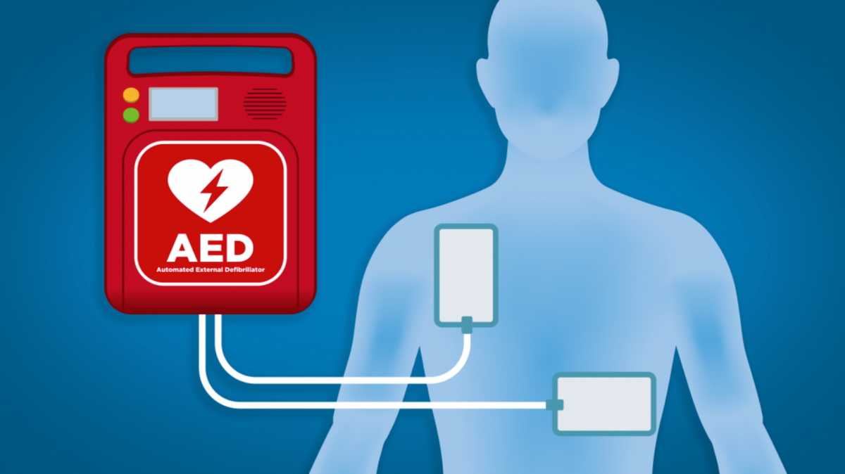 How AEDs in Public Places Can Restart Hearts — Equipment Express LLC